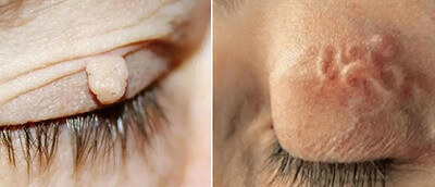 Schockierendes Geständnis: Die meisten Menschen sind mit Parasiten ...